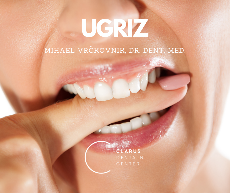 Ugriz - Clarus dentalni center